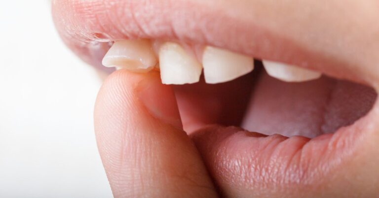 Baby Tooth Fell Out but Root Still In: Your Next Steps