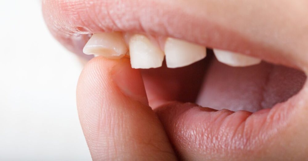 Baby Tooth Fell Out but Root Still In: Your Next Steps