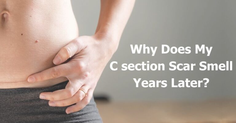 Why Does My C-Section Scar Smell Years Later & How to Fix It Why Does My C-Section Scar Smell Years Later & How to Fix It