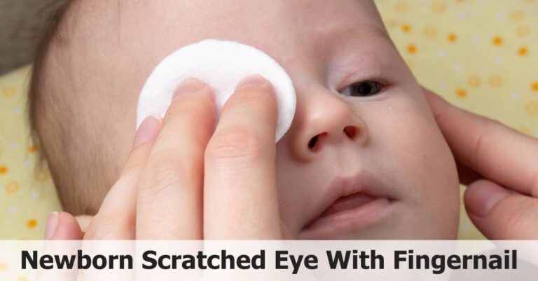 Newborn Scratched Eye With Fingernail - Immediate Steps to Take 👶