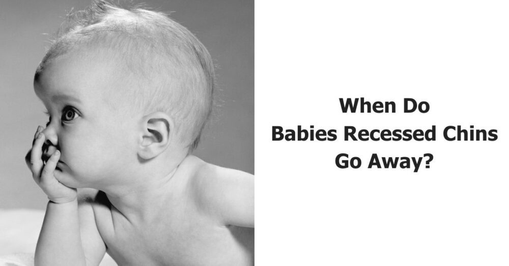 When Do Babies Recessed Chins Go Away? Natural Progression