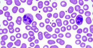 What Is Segmented Neutrophils & Why They Matter to Your Health