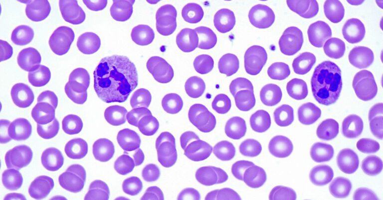 What Is Segmented Neutrophils & Why They Matter to Your Health