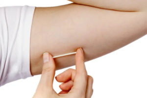 How Much Does Birth Control Implant Cost? | Guide to Prices & Insurance