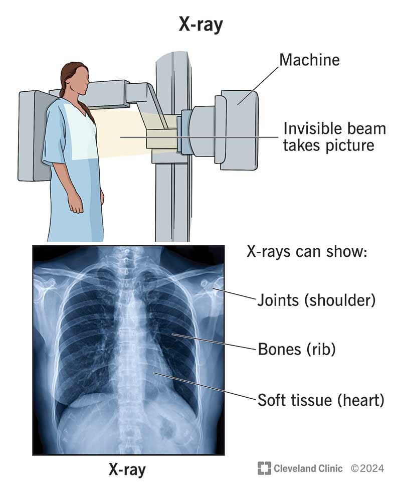How Long For X Ray Results? | Timely Insights