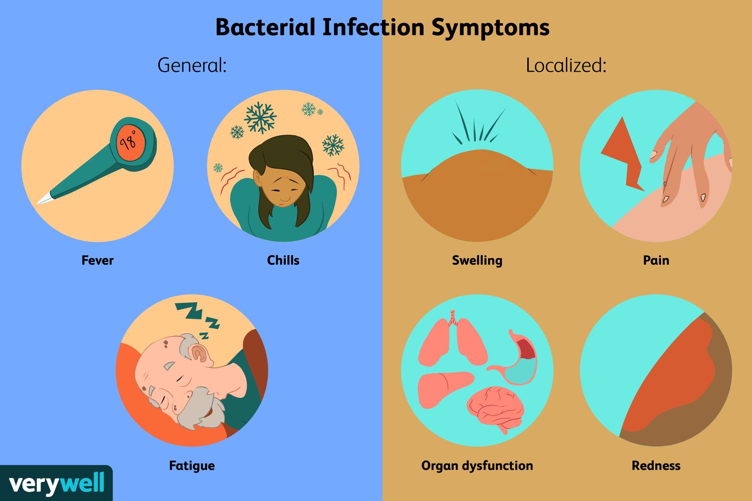 Understanding Rare Bacterial Infection | Essential Insights