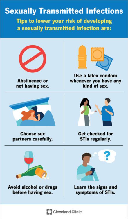 What Stds Can Be Detected By Urine? | Health Insights