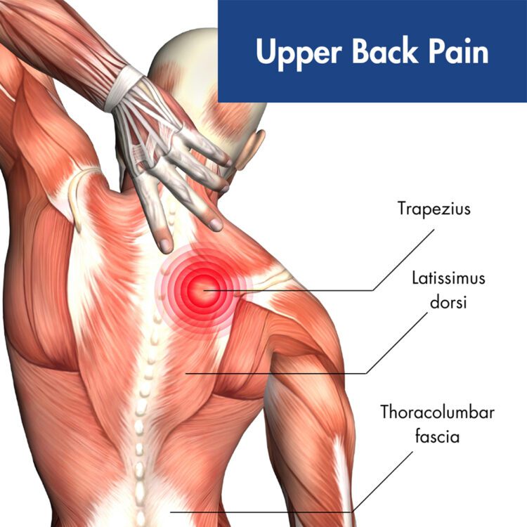 Pain upper back when turning head | Understanding Discomfort