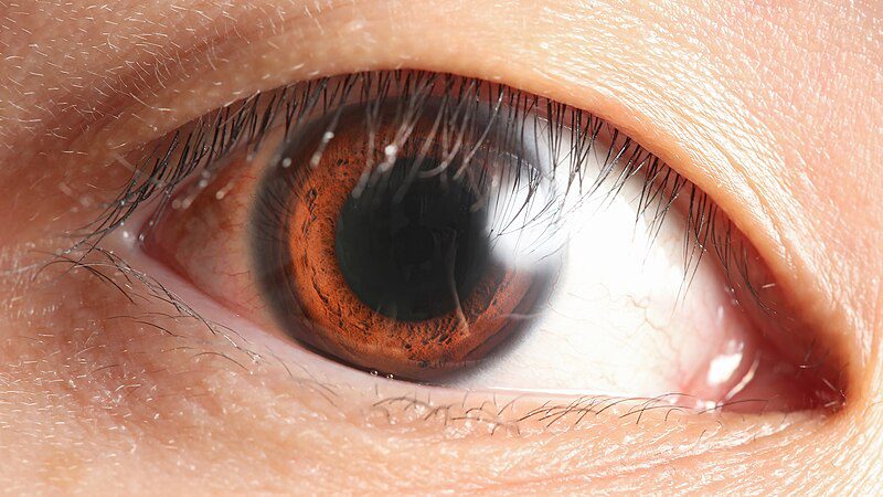 Will Your Eyes Get Stuck Crossed? | Eye Myths Unveiled
