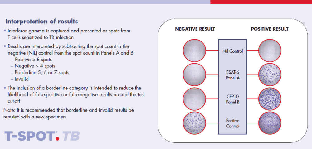 How Is T-spot Test Done? | Understanding the Process