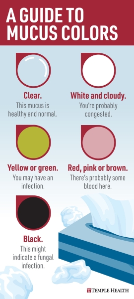 Does Color Of Mucus Indicate Infection? | Health Insights