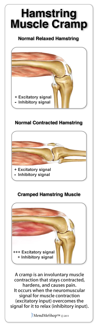 How To Treat Hamstring Cramp? | Effective Relief Methods