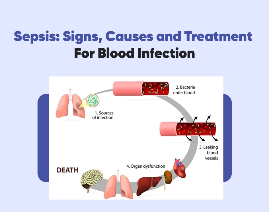 What Is An Infection In The Blood? | Critical Insights