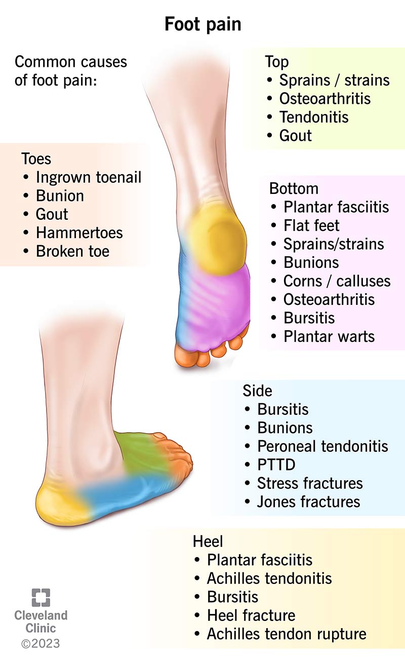 Pain In Back Of Foot When Walking? | Relief Strategies