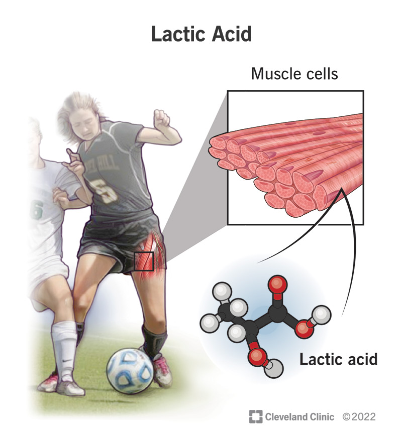 What Level Of Lactic Acid Is Fatal? | Critical Insights