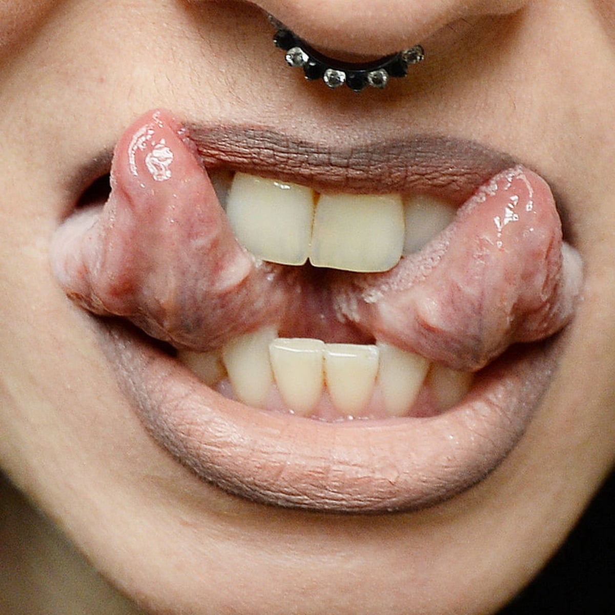 How To Treat Cut On Tongue? | Swift Healing Tips