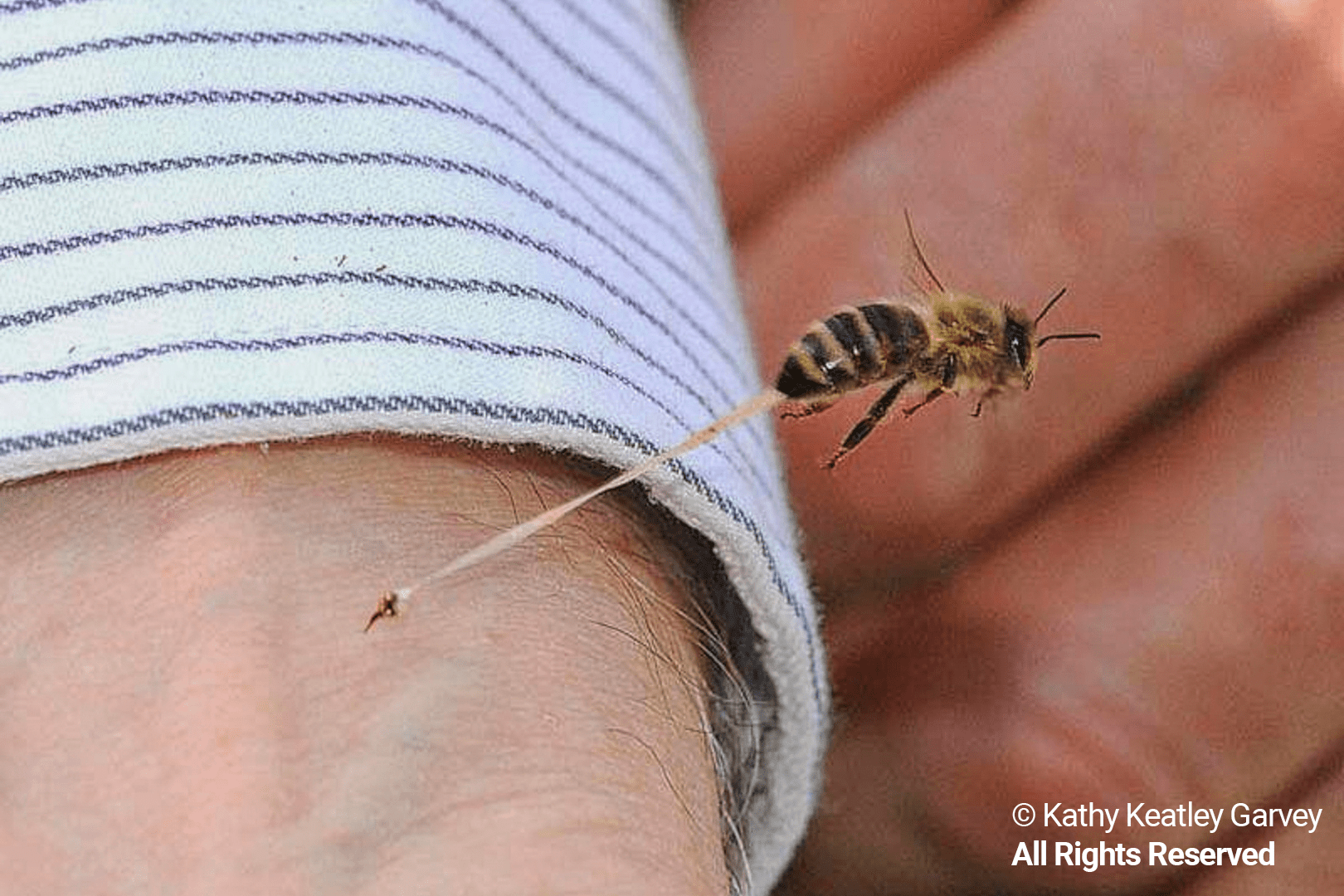 What Are The Symptoms Of A Bee Sting? | Buzzing Insights