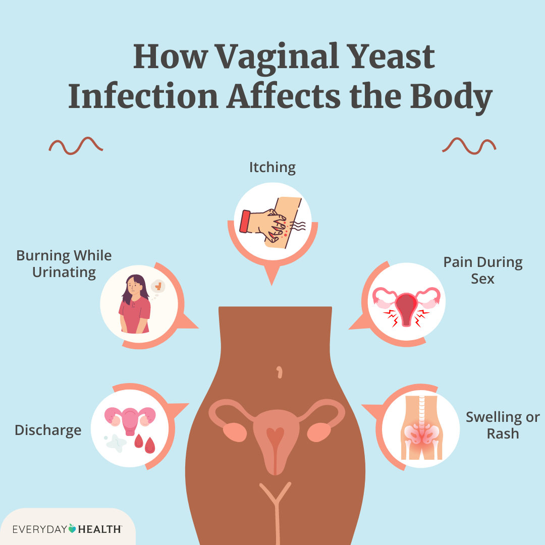 Can You Pass A Yeast Infection To A Man? | Health Insights