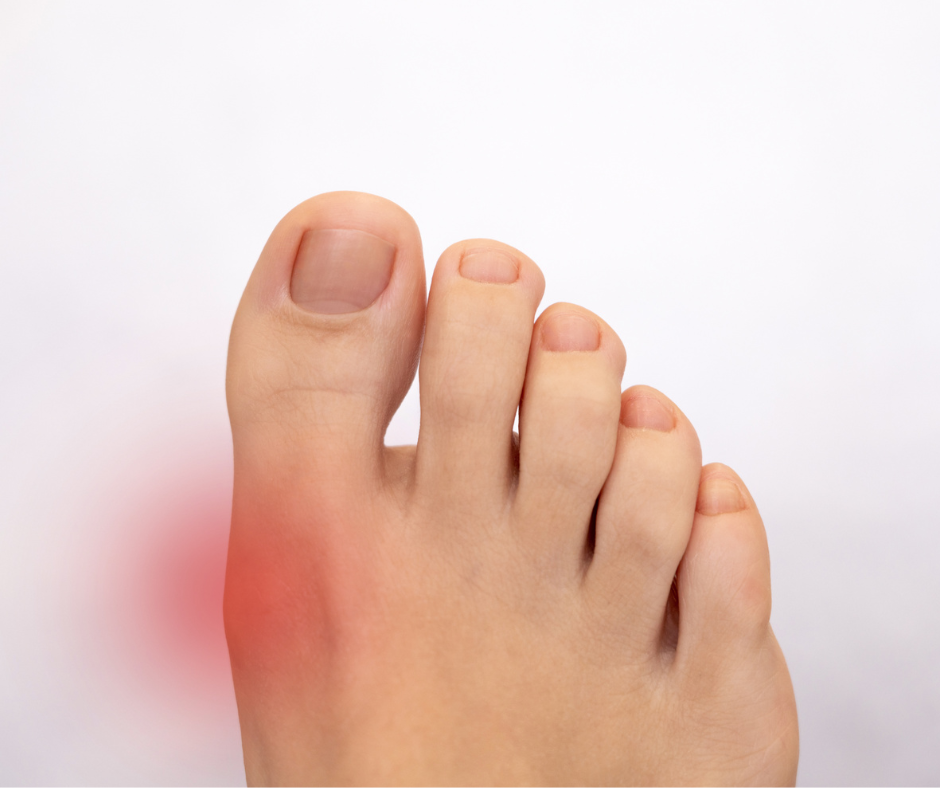 Why Is My Big Toe Twitching? | Understanding Muscle Spasms