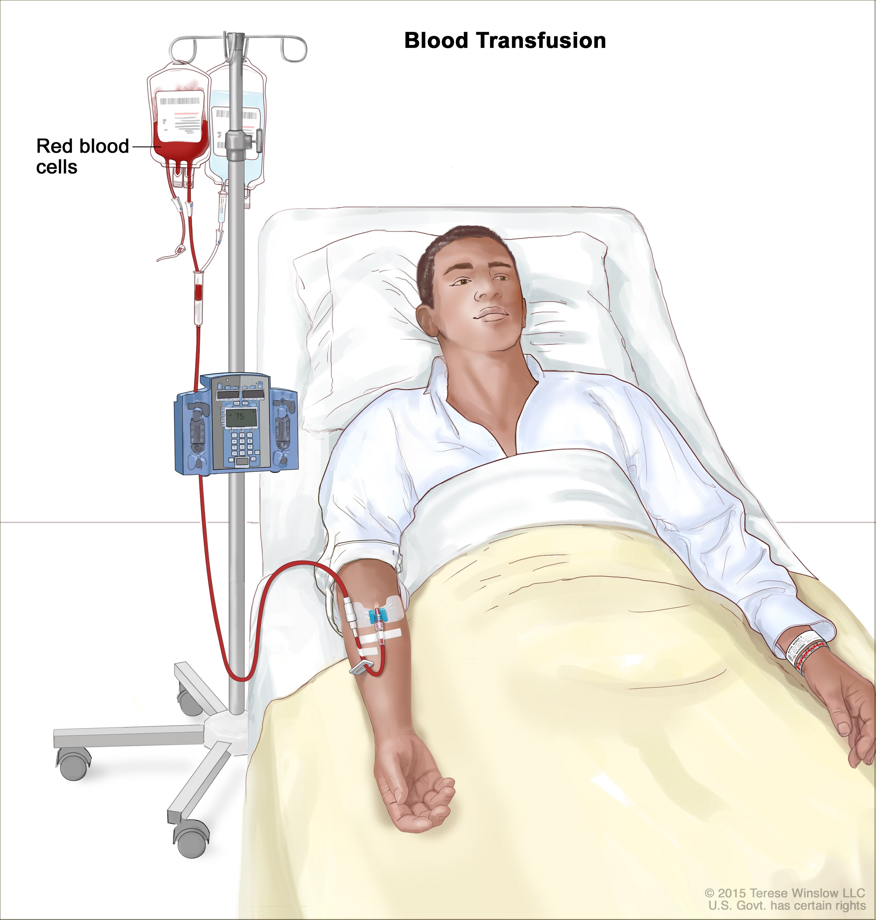 How long does a blood transfusion take? | Vital Insights